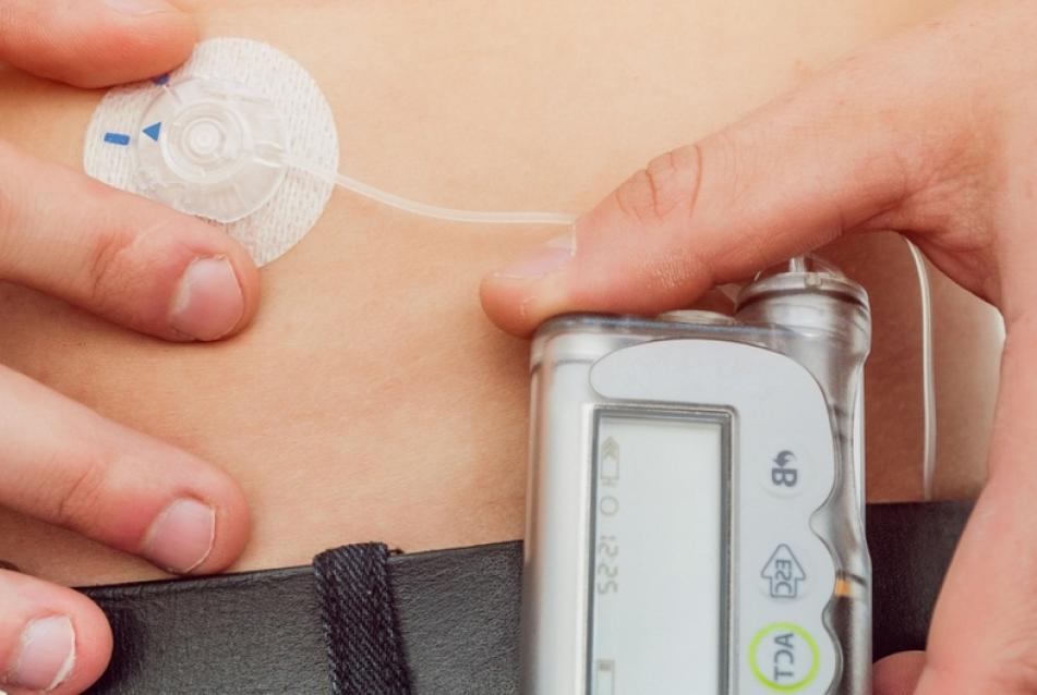 What You Should Know About PEBAX® for Medical Applications